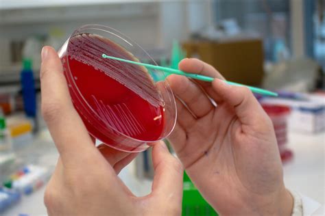 Bacteriology And Mycology Unit Nmbu