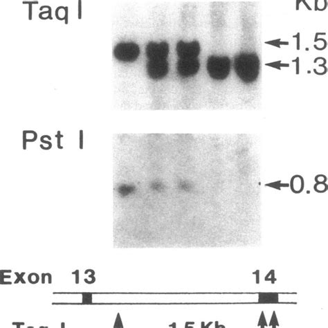 Southern Blot Analysis Of Genomic Dnas From Siblings With Prolidase