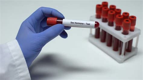 Sex Hormone Doctor Showing Blood Sample In Tube Lab Research Health Checkup Stock Footage
