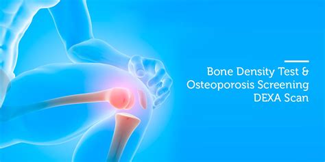 Bone Density Test Osteoporosis Screening DEXA Scan Blog Trivitron Healthcare Solutions