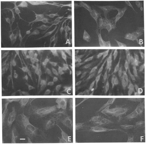 Immunofluorescence Staining For Tubulin Effect Of Hy Treatment Clones