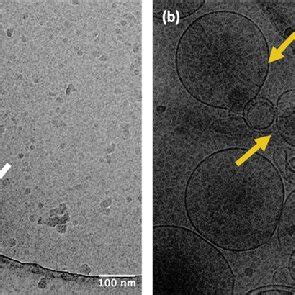 Cryo EM Image Reveals The Successful Encapsulation Of Ad A Naked Ad