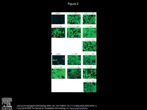 Jens M Baron Ruth Heise William S Ppt Download