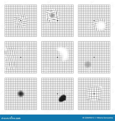 Oculist Amsler Eye Test Grid Vector Printable Chart Retina Examination