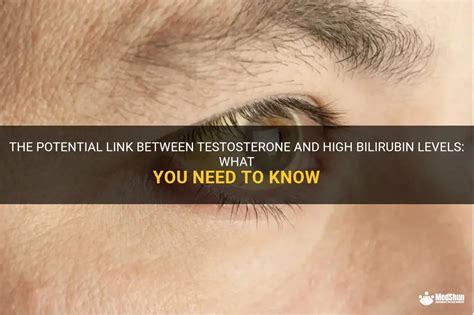 The Potential Link Between Testosterone And High Bilirubin Levels What You Need To Know Medshun