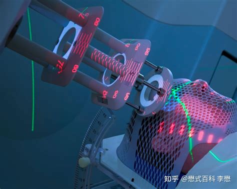 术前放疗可以吗？ 知乎