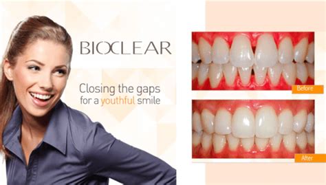 Bioclear Health Centered Dentistry Holistic Dentist