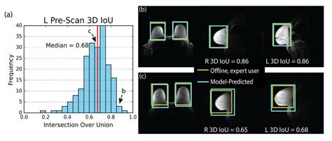 The Pre Scan Volume 3D Intersection Over Union IoU Histogram A