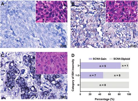 Correlation Between Notch2nl Expression And Scna Status A C