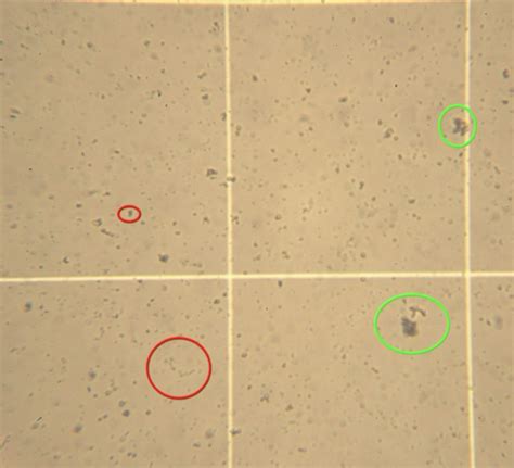 Effects Of Common Supplements On Human Platelet Aggregation In Vitro Journal Of Emerging