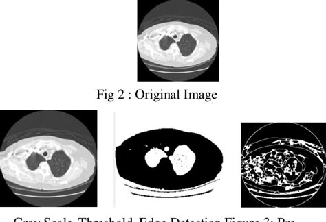 Figure 2 From Detection Of Various Lung Diseases Using Machine Learning Semantic Scholar