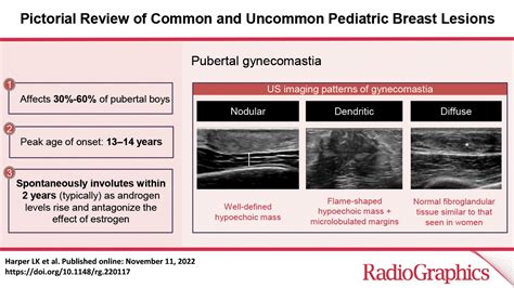 Pictorial Review Of Common And Uncommon Pediatric Breast Lesions