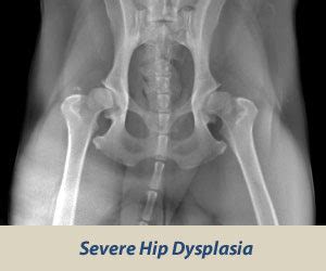 Hip Dysplasia Ofa