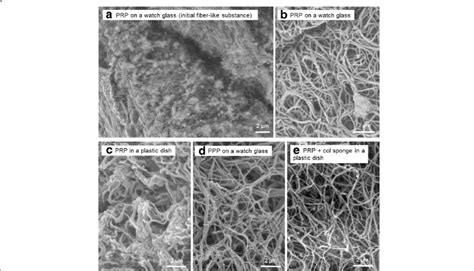 Sem Analysis Of The Surface Microstructures Of Formed Fibrin Clots A A Download Scientific