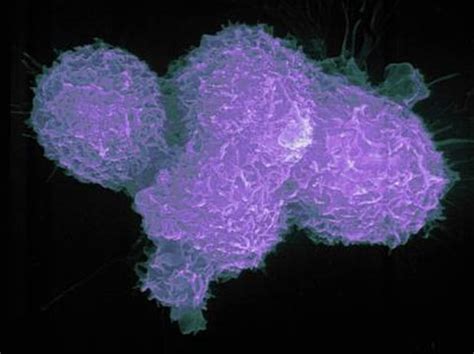 Probiotics May Help Treat Patients At Risk Of Colorectal Cancer