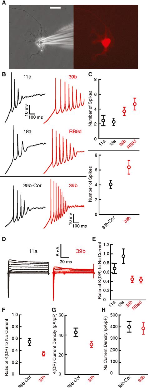 Figure 2 From Intrinsic Membrane Hyperexcitability Of Amyotrophic