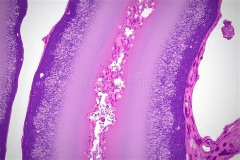 Microscopic Analysis Of Tissue Section Revealing Lumen And Connective