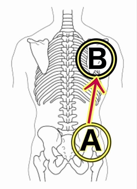 Theory Of Kochi Method On The Piriformis Treatment