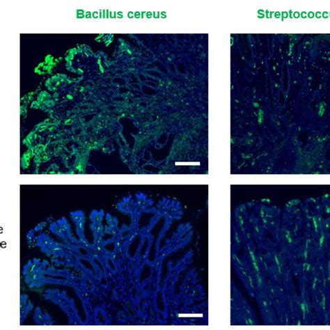 Immunohistochemical Staining For Bacteria In Gastric Cancer In Pure Aig