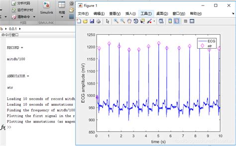 matlab下wfdb的吐血安装 警告 your wfdb toolbox installation path contain wh csdn博客