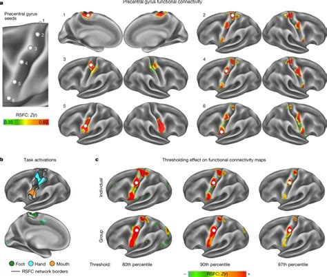 A Somato Cognitive Action Network Alternates With Effector Regions In