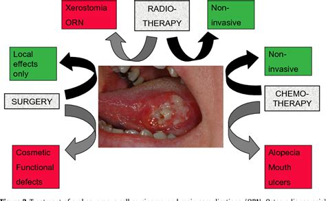 Table 2 From Oral Squamous Cell Carcinoma Overview Semantic Scholar