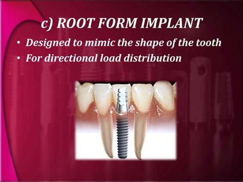 Types And Classification Of Dental Implants Pptx Operating Systems