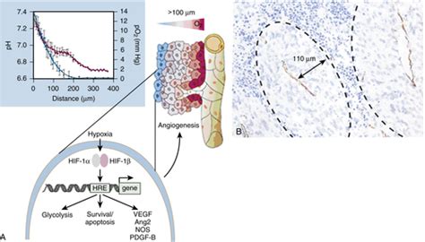 Tumor Angiogenesis Oncohema Key