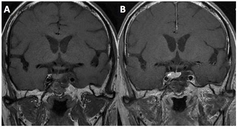 Medial To Lateral