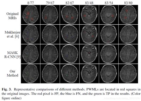 医学图像分割 （miccai 2019）selective Feature Aggregation Network With Area Bo