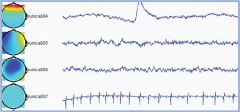 Fieldtrip Walkthrough Fieldtrip Toolbox