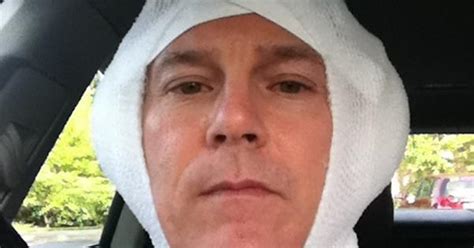 My Dad Got Ear Surgery And Now Has To Wear This For The Next Few Days