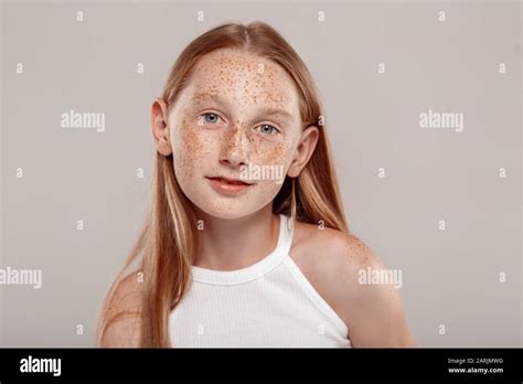 Inclusive Beauty Girl With Freckles Standing Isolated On Grey Posing