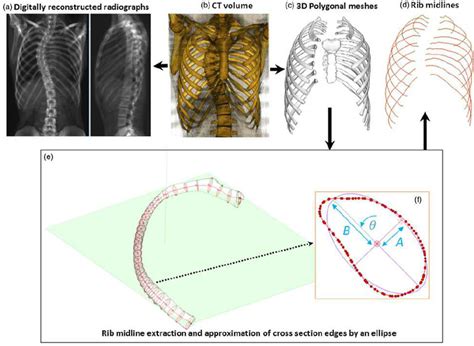 data extraction from ct scans the ct volumetric dataset b was used