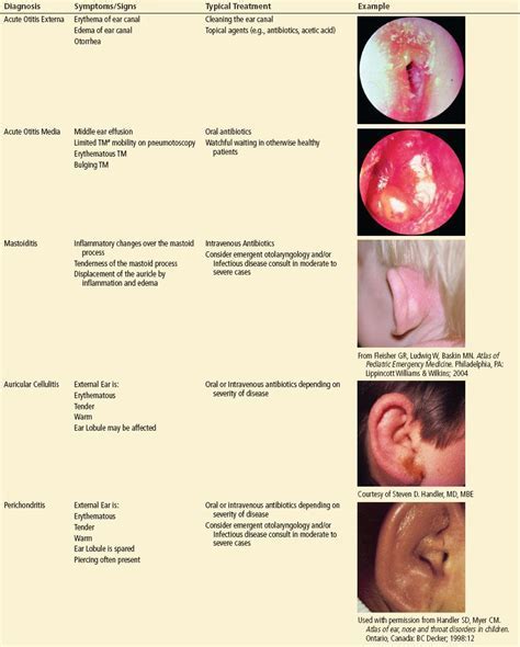 What Cpt Code To Use For Ear Infection