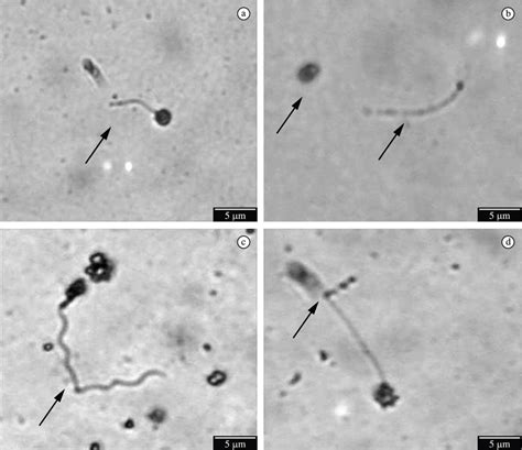 Illustrations Of Morphologies Observed In The Semen Of Brycon Download Scientific Diagram