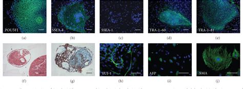 Figure 2 From Derivation Of Two New Human Embryonic Stem Cell Lines