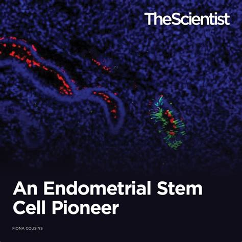 The Scientist On Linkedin Researchers Have Found Adult Stem Cells In