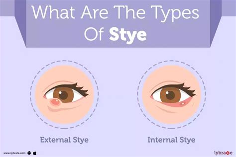 Stye Causes Symptoms Treatment And Cost