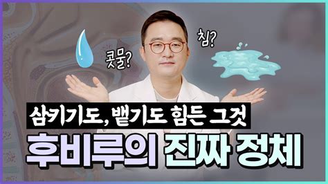 목에 걸린 게 도대체 뭐죠 후비루의 진짜 정체를 밝힙니다 Youtube