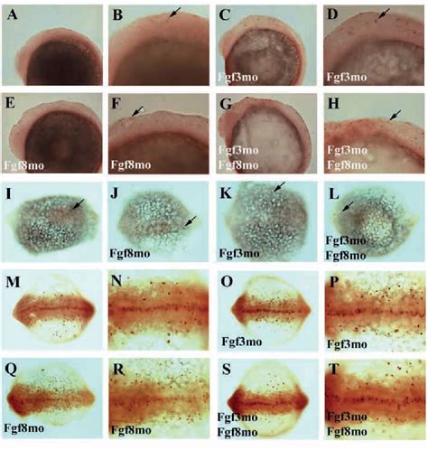 Otic Placode Semantic Scholar