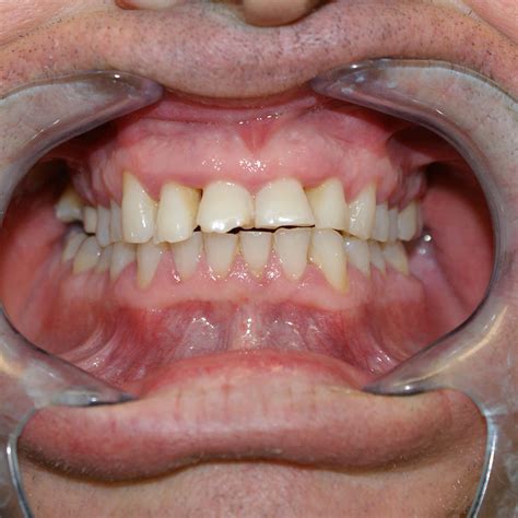 Bioclear Theydon Dental Surgery