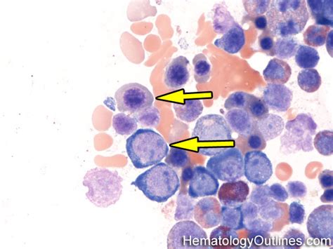 Hematologyoutlines Atlas