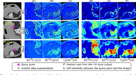 figure 1 from keypoint augmented self supervised learning for medical