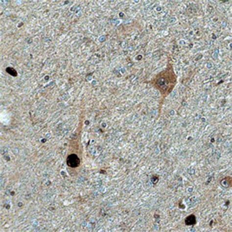 Human Cam Kinase I Antibody R D Systems 100μg Unlabeledantibodies