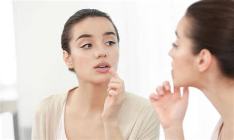 Cold Sore Or Pimple Suffering From Either Know How To Treat It