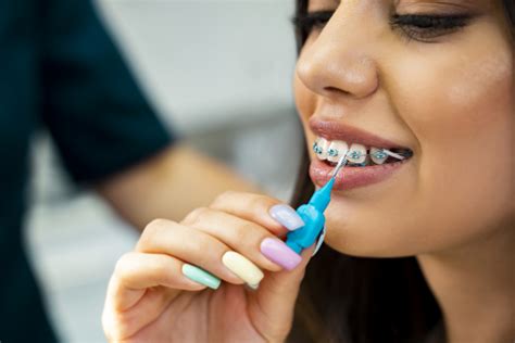 Uncomfortable Truths Why Dental Floss Gets Stuck With Braces And How
