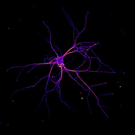 Neuron Synapse Microscope