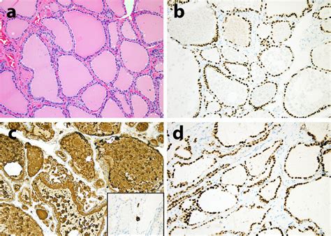 Normal Thyroid A Thyroid Tissue Is Characterized By Follicles Download Scientific Diagram
