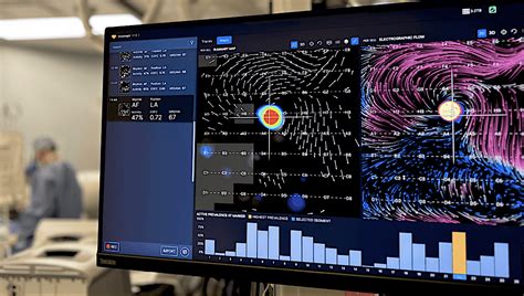 Boston Scientific Agrees To Acquire Afib Ablation Company